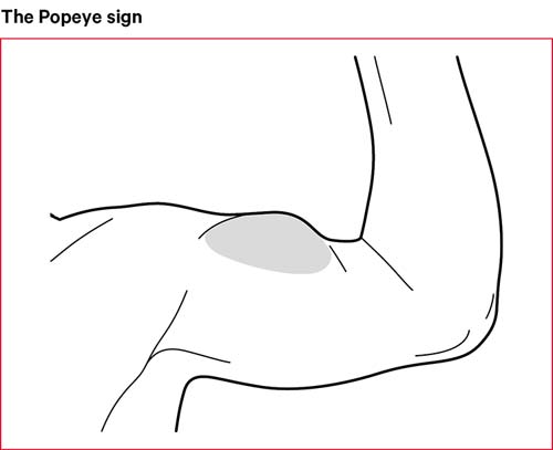 肘部疼痛| Causes, exercise, treatments | Versus Arthritis - beplay3体育